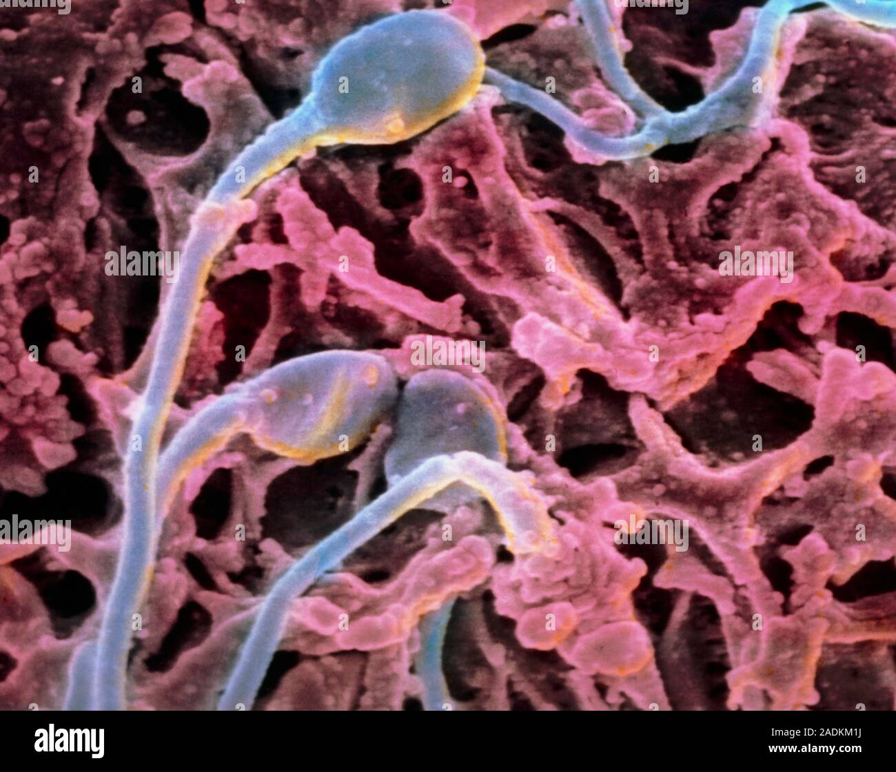 Fertilisation. Coloured Scanning Electron Micro- graph (SEM) of sperm ...