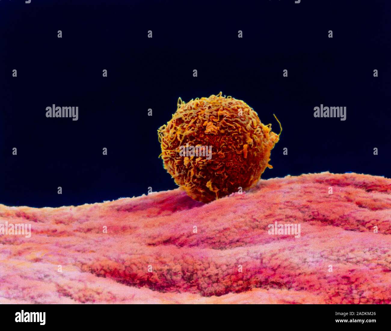 Fertilisation. Coloured Scanning Electron Micro- graph (SEM) of sperm ...