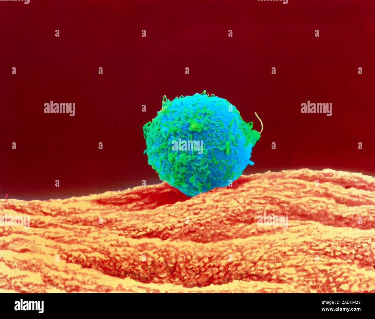 Fertilisation. Coloured Scanning Electron Micro- graph (SEM) of sperm ...