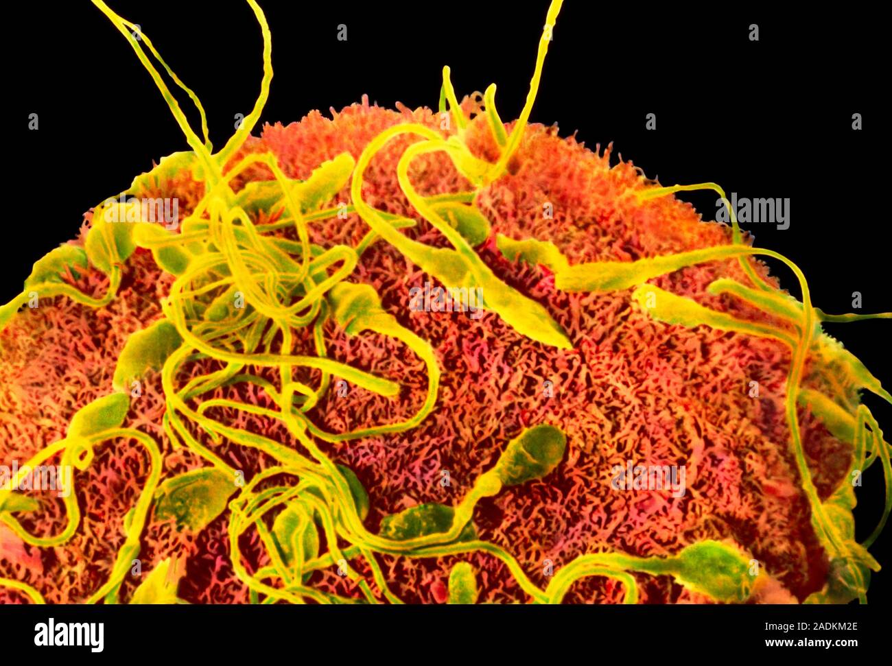 Fertilisation. Coloured scanning electron micro- graph (SEM) of sperm ...