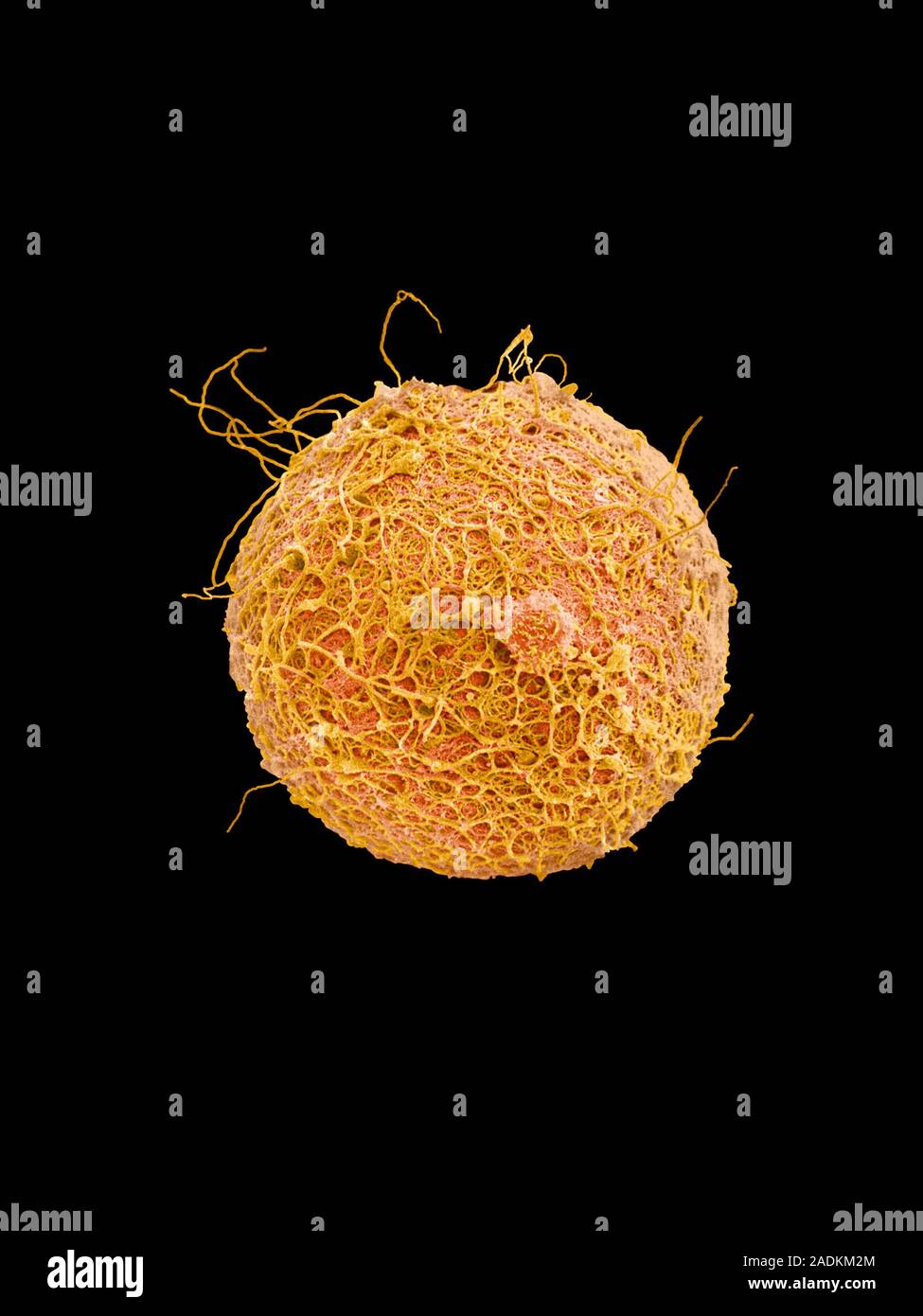 Fertilisation. Coloured scanning electron micro- graph (SEM) of sperm ...
