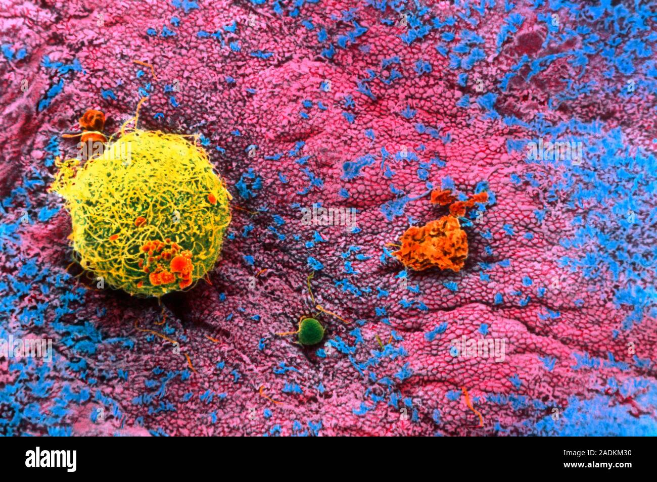 Fertilisation. Coloured scanning electron micrograph (SEM) of a human ...
