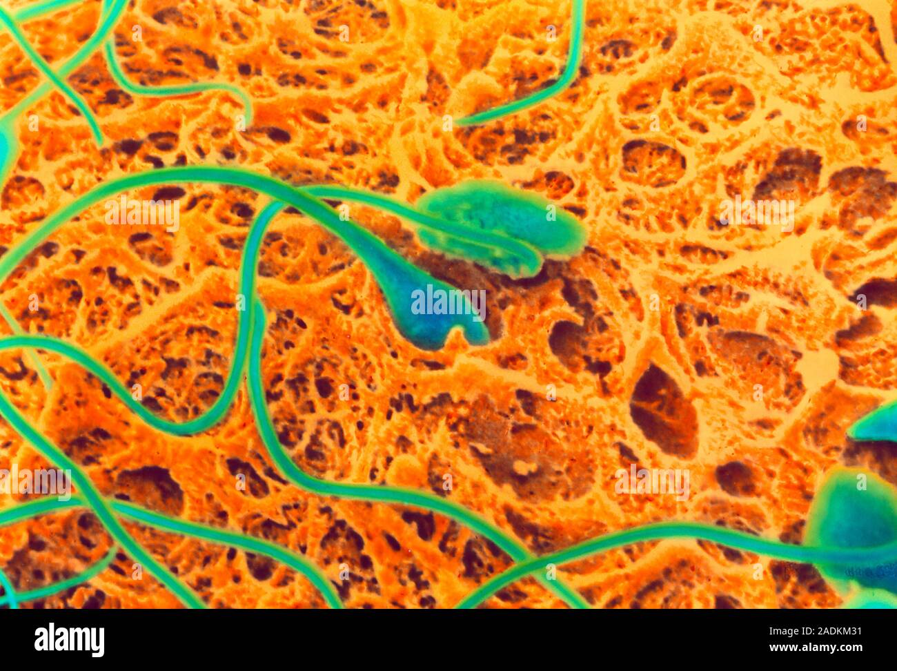 Egg fertilisation. Coloured scanning electron micrograph (SEM) of sperm ...