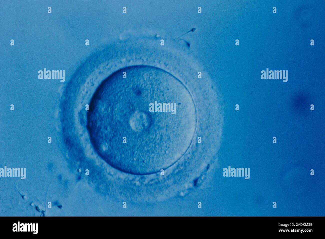 Fertilised human egg. Light micrograph of a human egg cell after ...