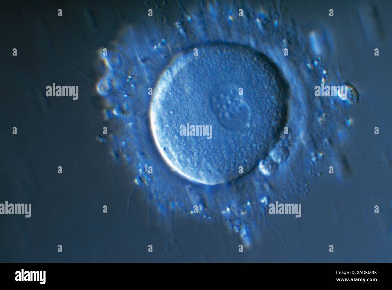 Fertilisation. Light micrograph of a human egg cell during ...