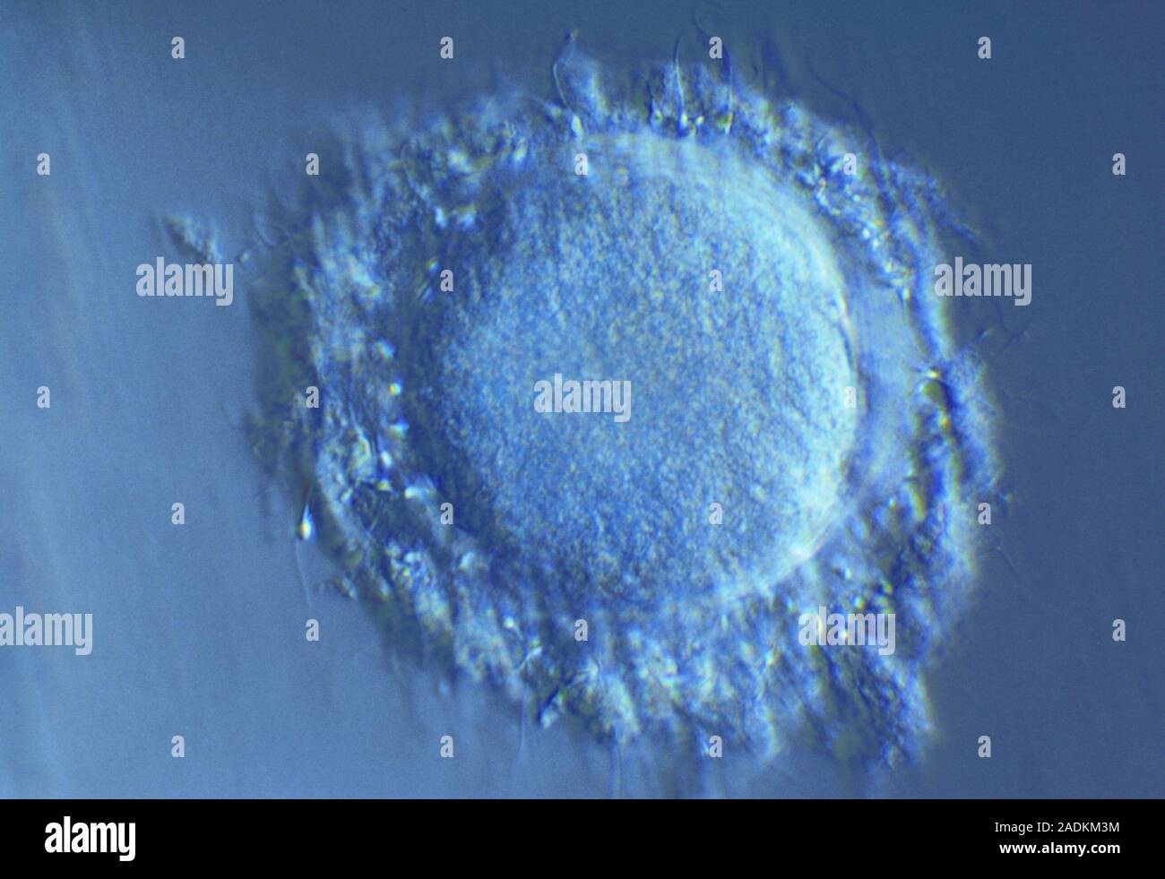 Fertilisation. Light micrograph of a human egg cell surrounded by ...