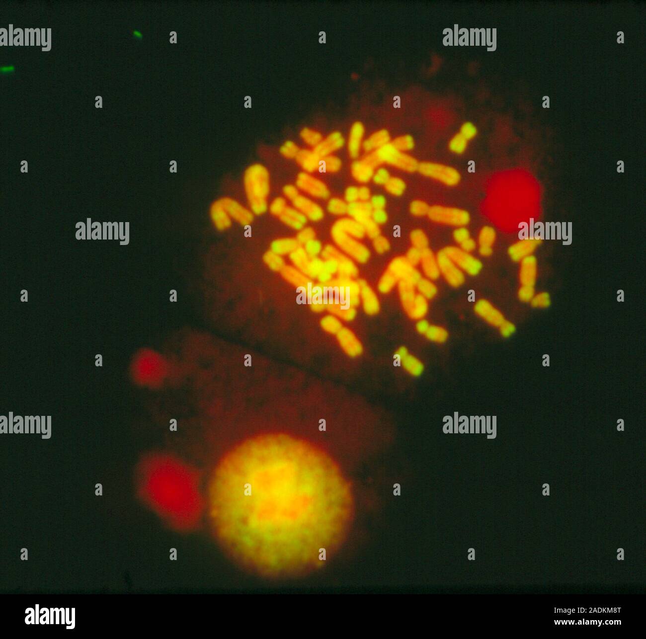 Fluorescence light micrograph of a set of human chromosomes from an ...