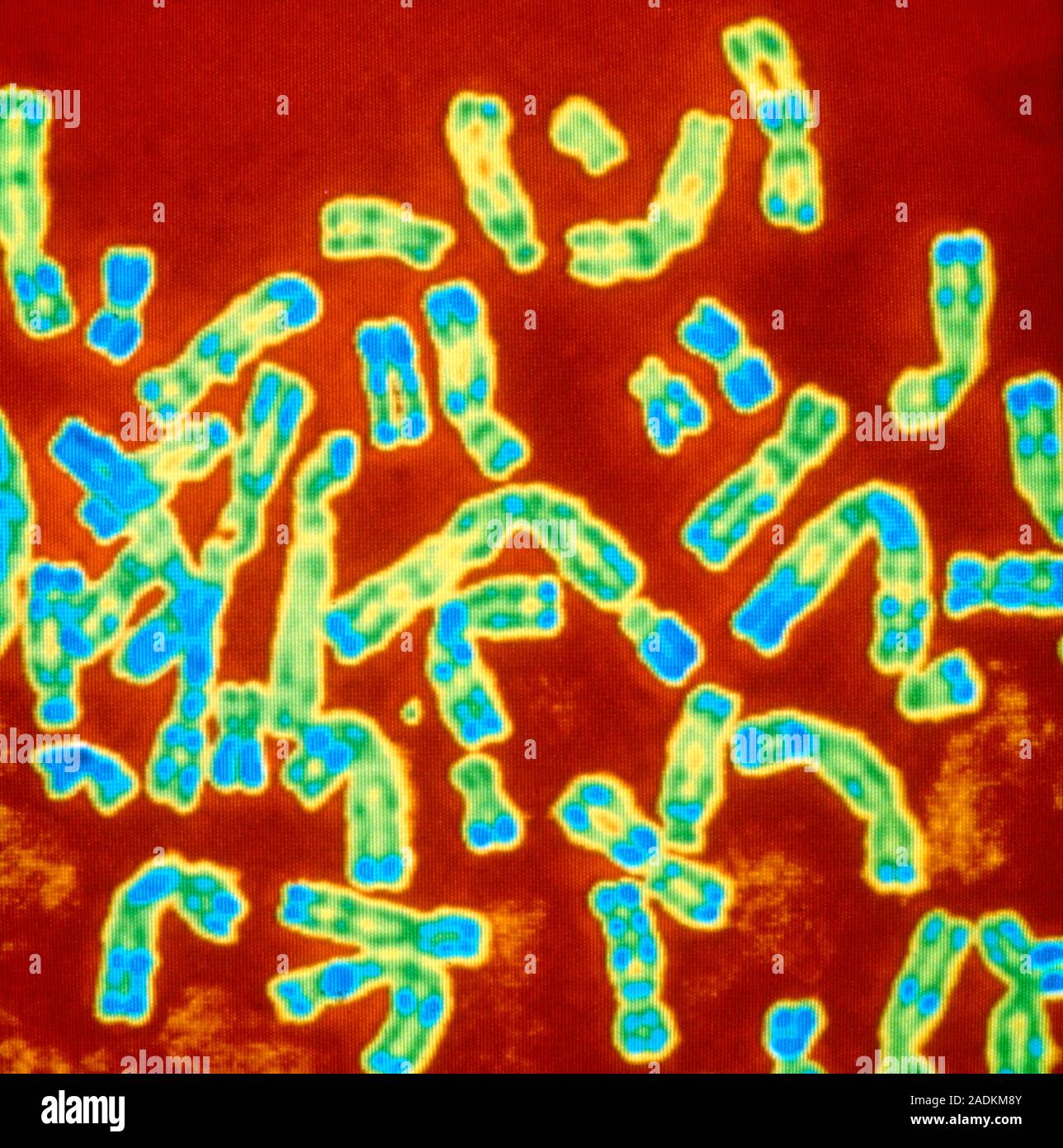 False-colour, computer-enhanced light micrograph of human chromosomes ...