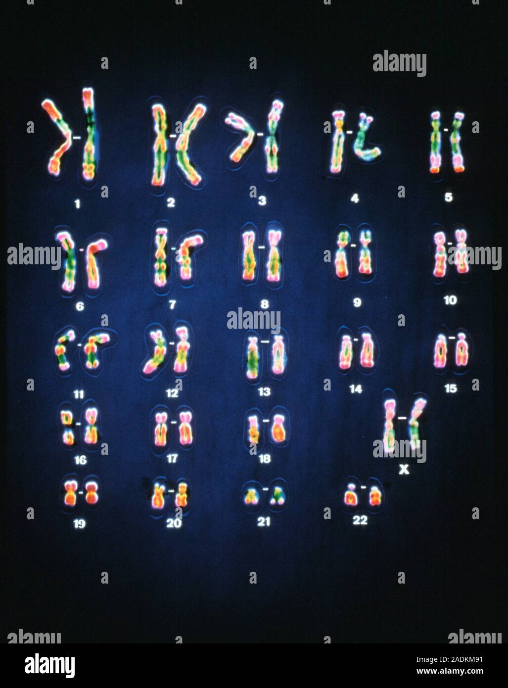 False-colour light micrograph of a normal trypsin/leishman banded ...