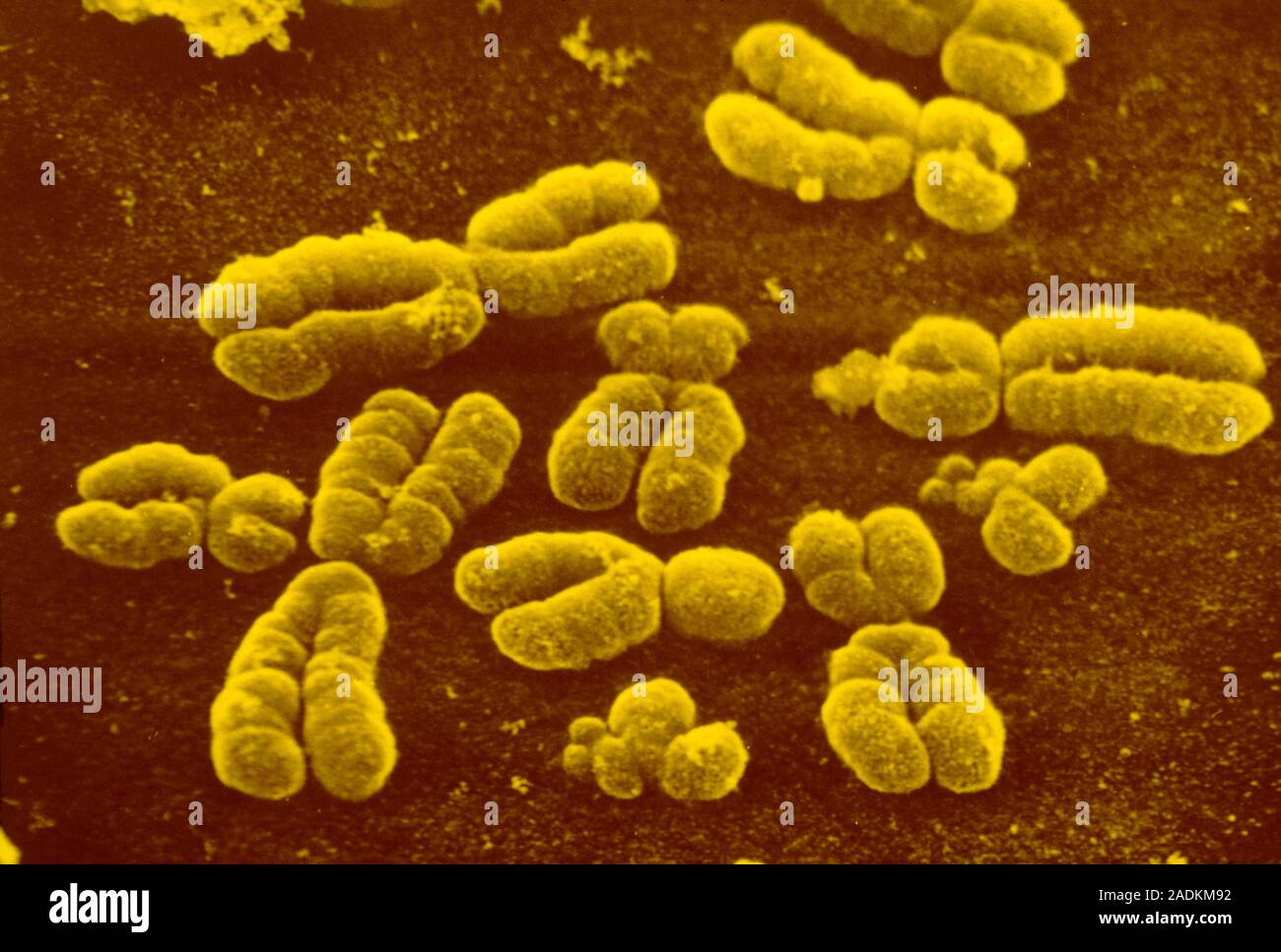 False-colour scanning electron micrograph (SEM) of a group of human ...