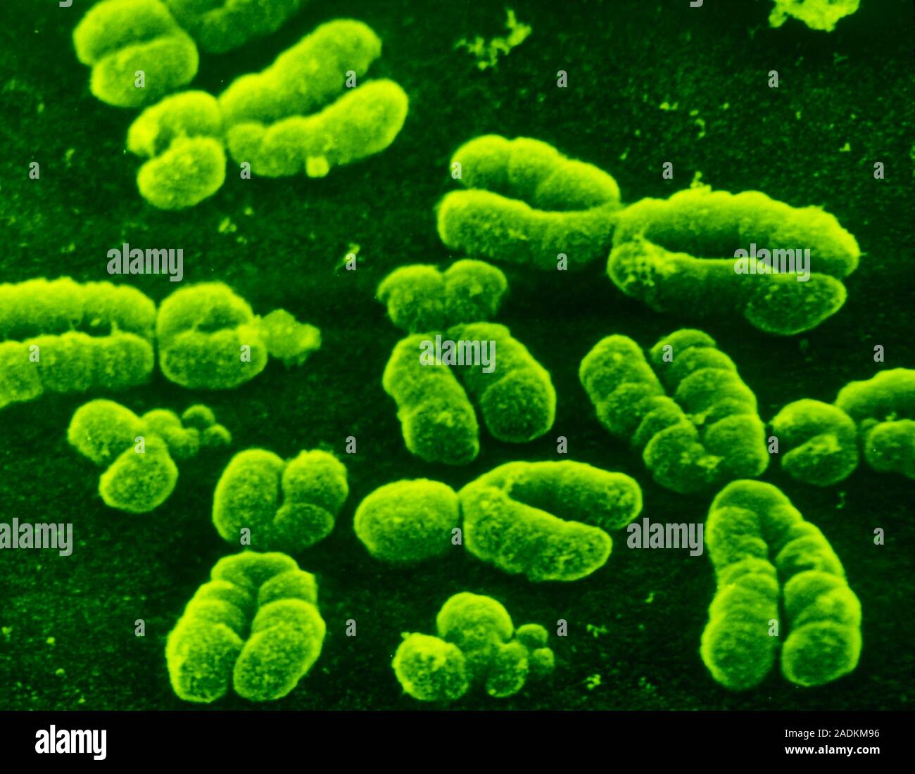 False-colour scanning electron micrograph (SEM) of a group of human ...