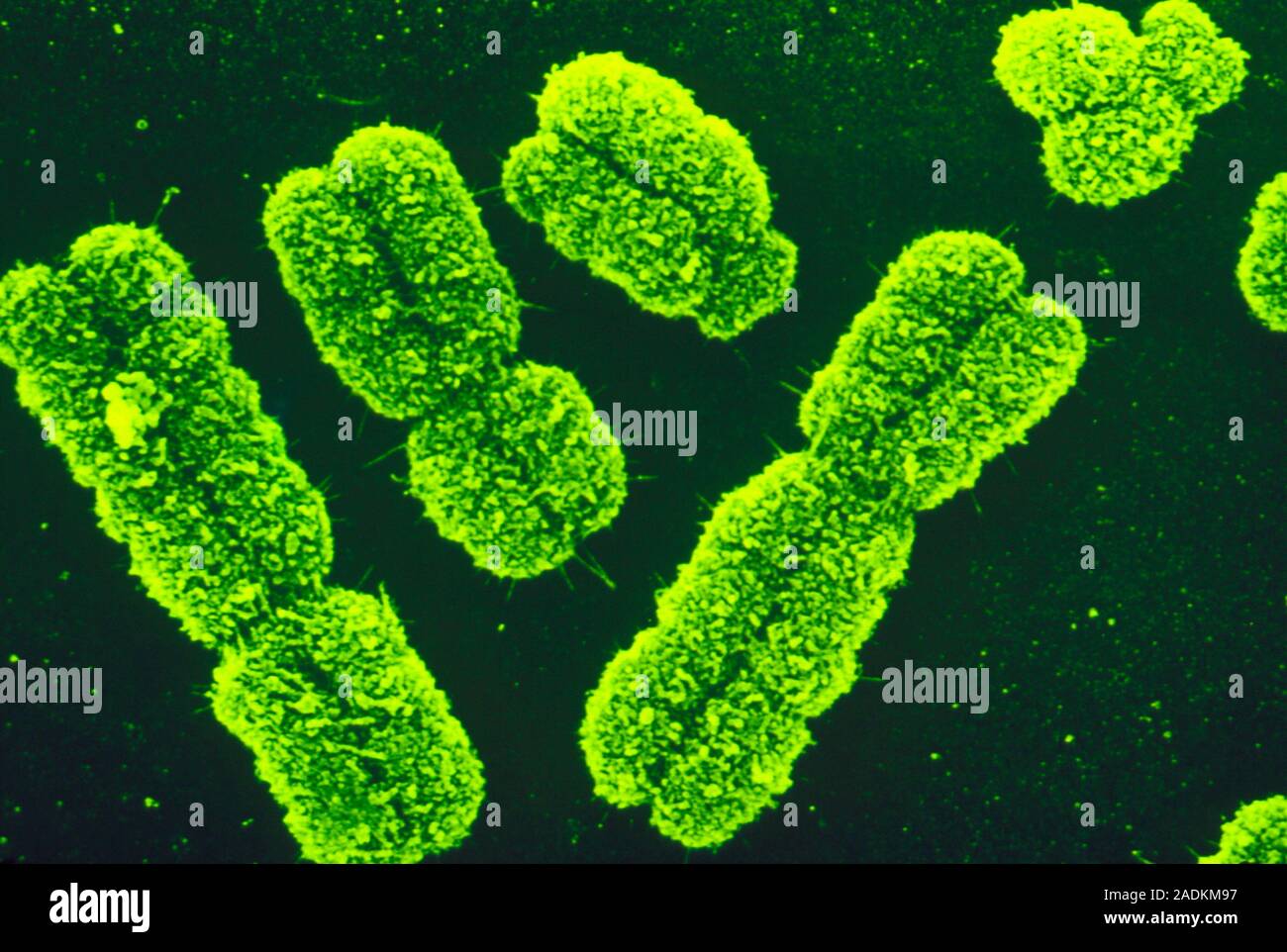 False-colour scanning electron micrograph (SEM) of a group of human ...