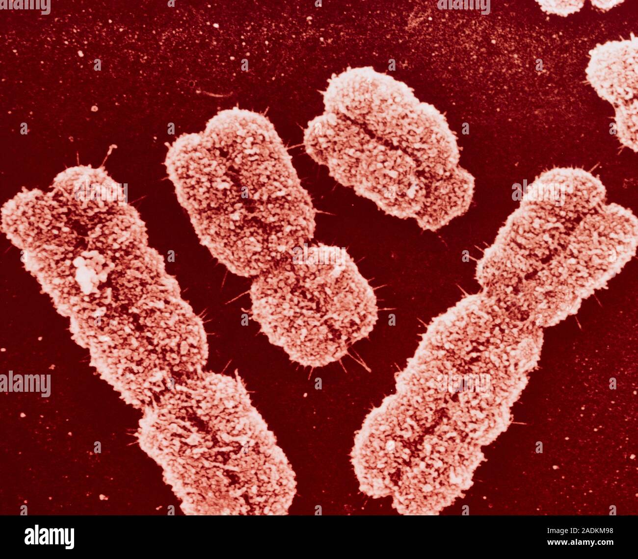 False-colour scanning electron micrograph (SEM) of a group of human ...