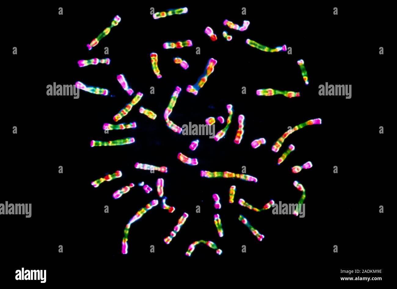 False-colour light micrograph of a normal set of human chromosomes, the ...
