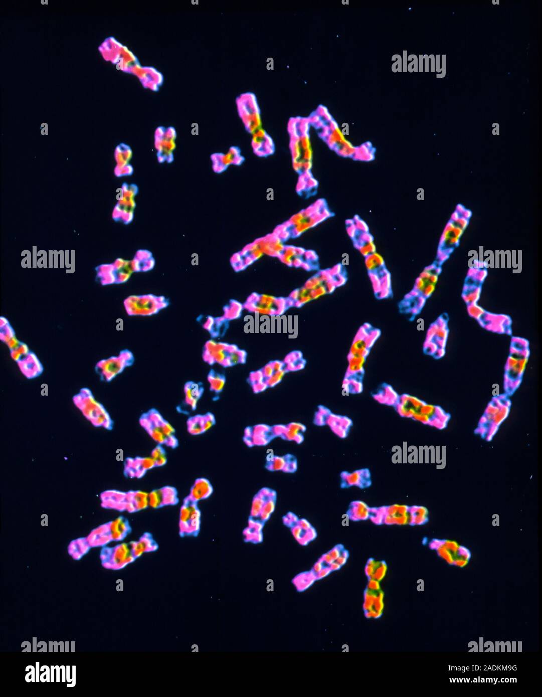 False-colour light micrograph of normal human chromosomes, obtained by ...