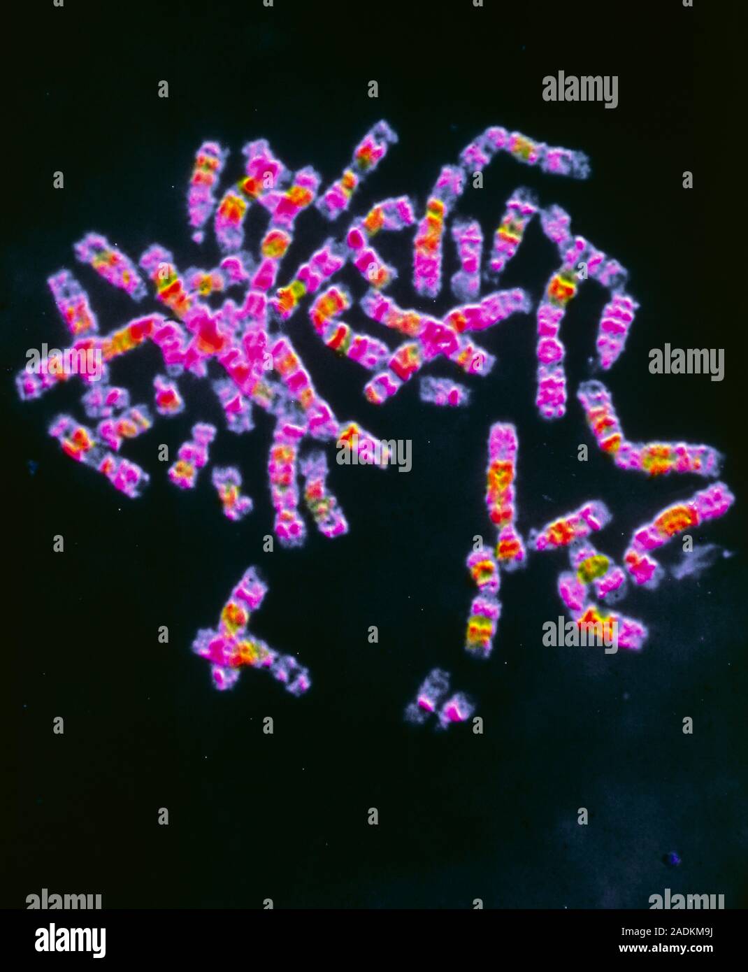 False-colour light micrograph of normal human chromosomes, obtained by ...