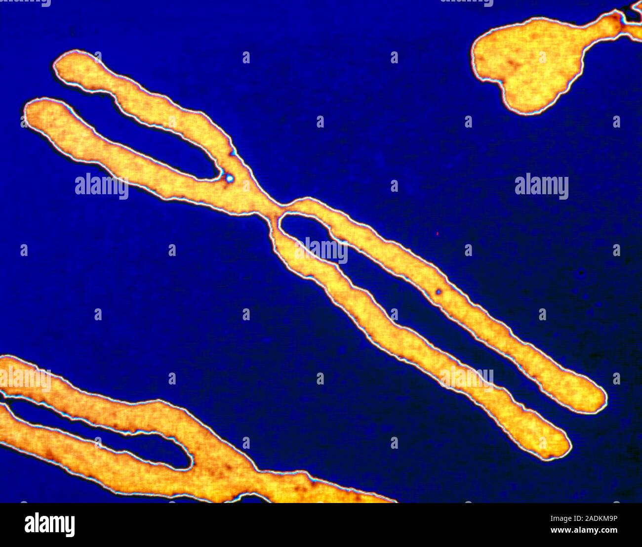 Chromosomes. Computer-enhanced light micrograph of human chromosomes ...