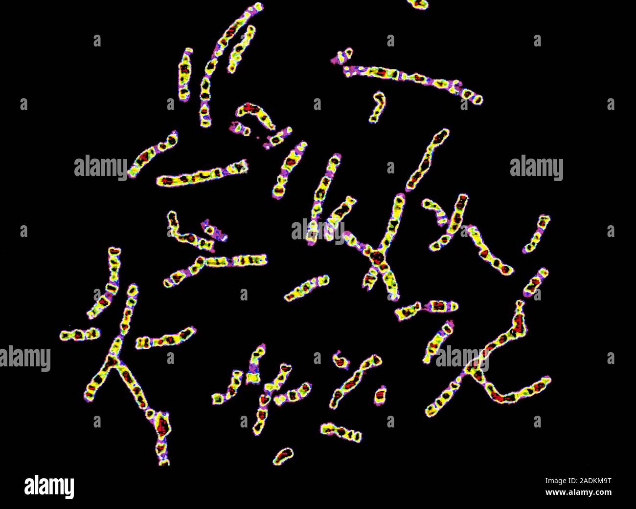 Digitised-colour light micrograph of normal human chromosomes ...