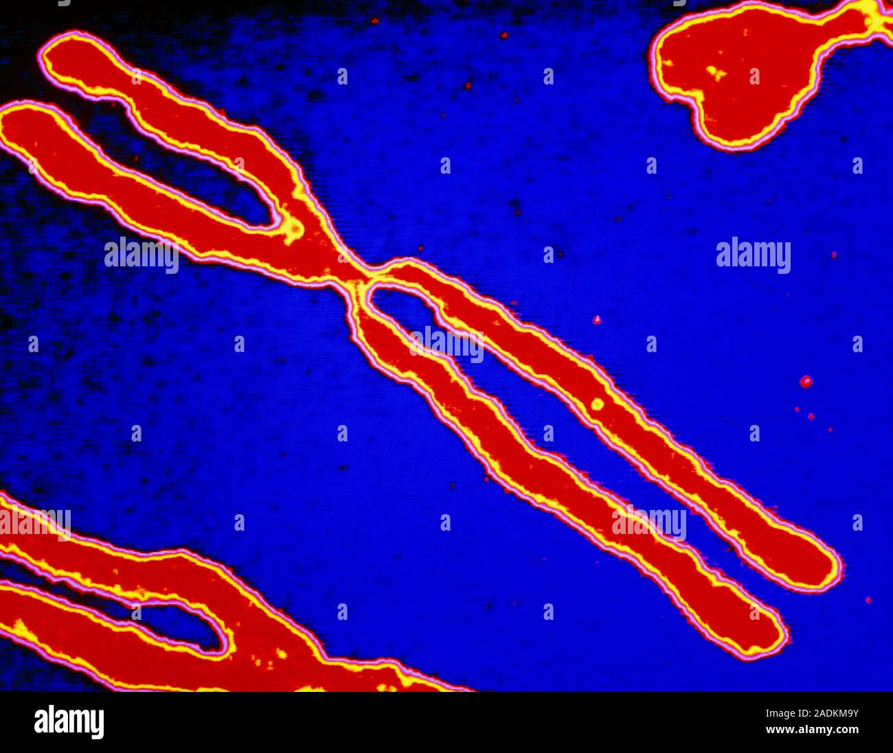 Chromosomes. Computer-enhanced light micrograph of human chromosomes ...