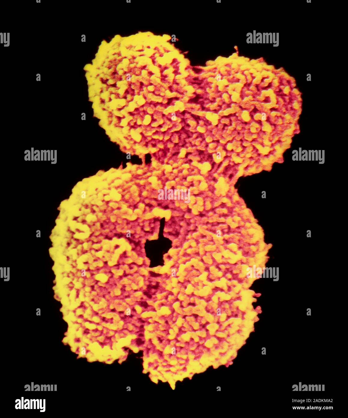 Human chromosome. Coloured Scanning electron micrograph (SEM) of a ...