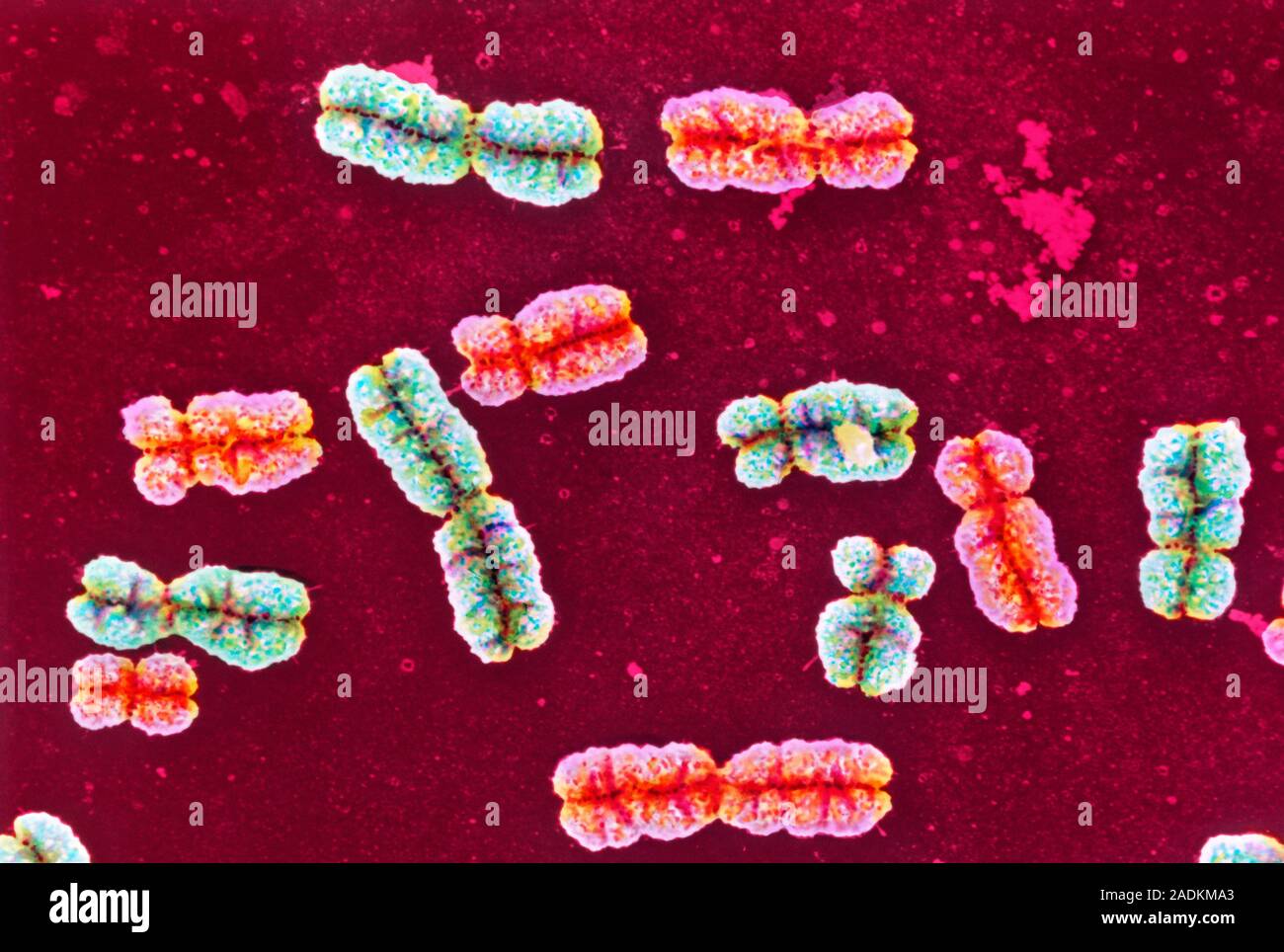 Human chromosomes. Coloured scanning electron micrograph (SEM) of a ...