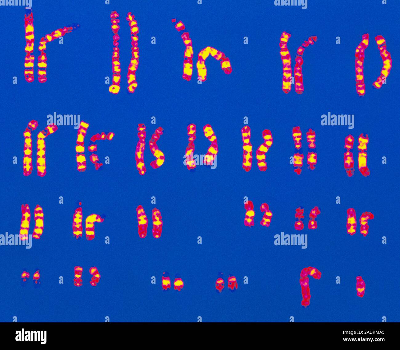 Male chromosomes. Coloured light micrograph of a normal trypsin ...