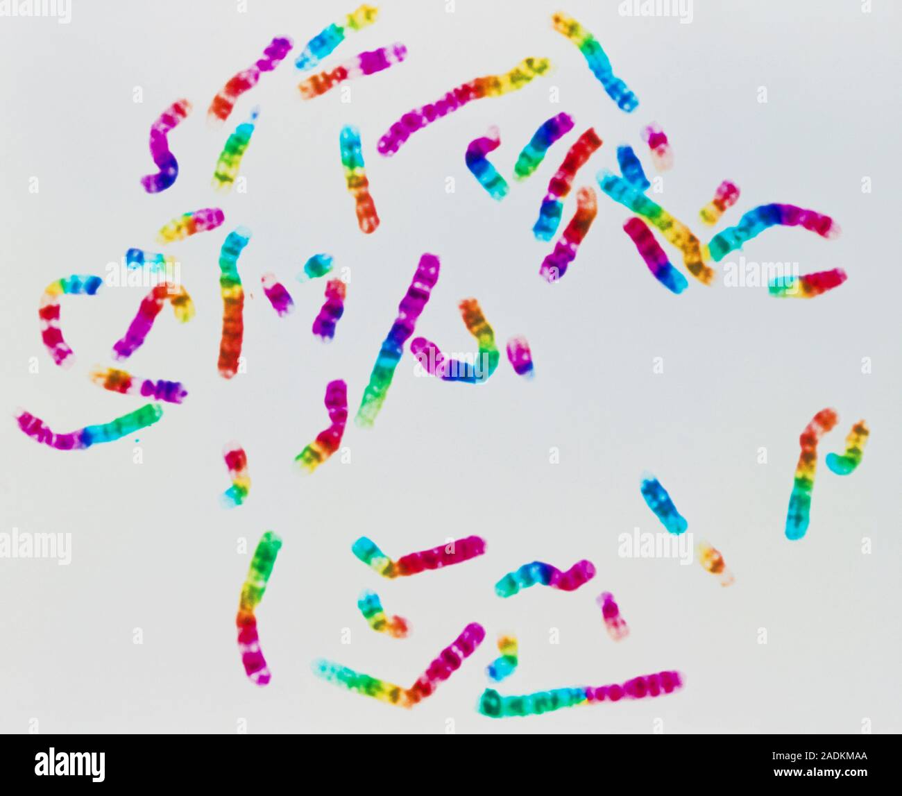 Male chromosomes. Coloured light micrograph of a normal, full ...