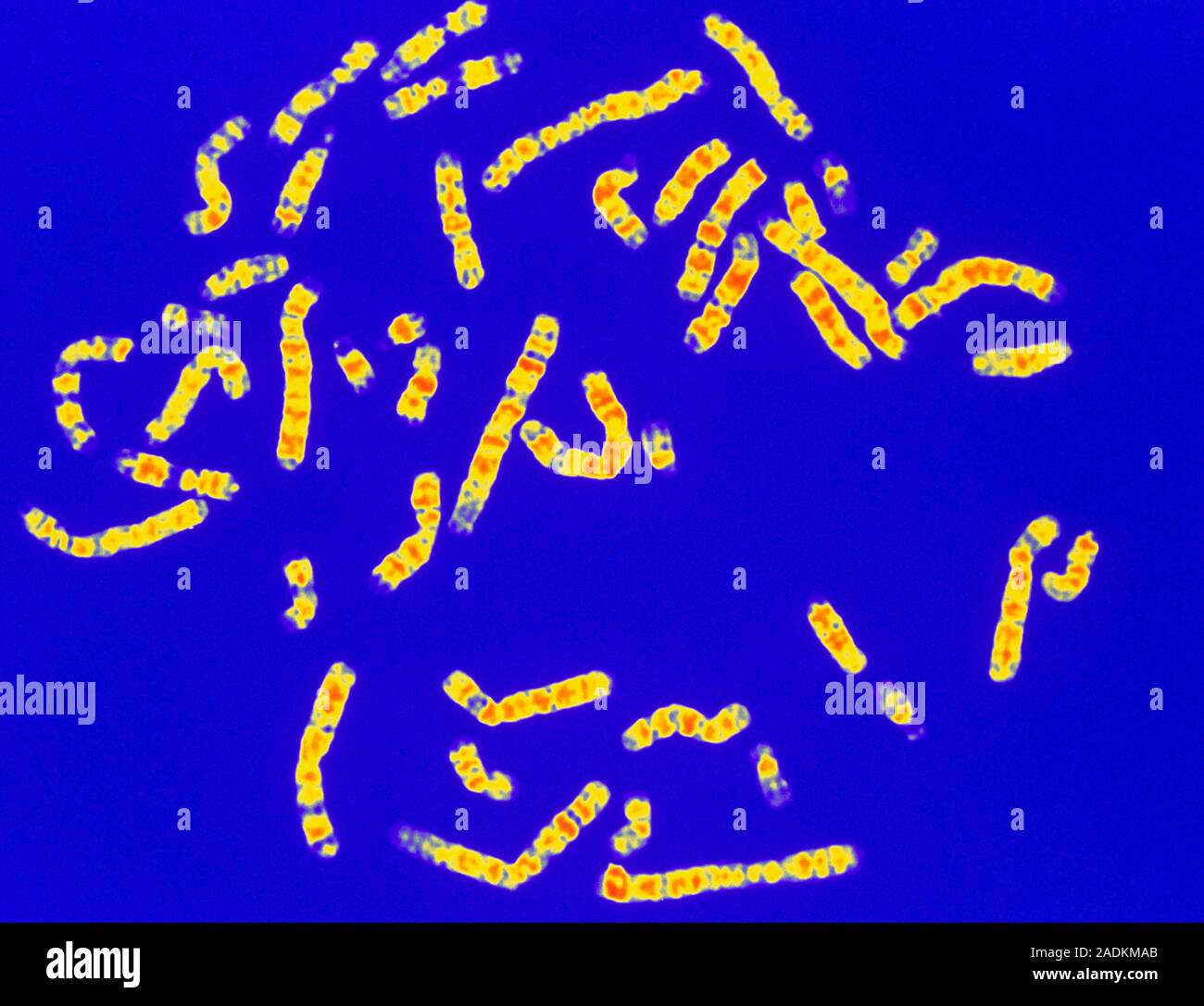 Male chromosomes. Coloured light micrograph of a normal, full ...