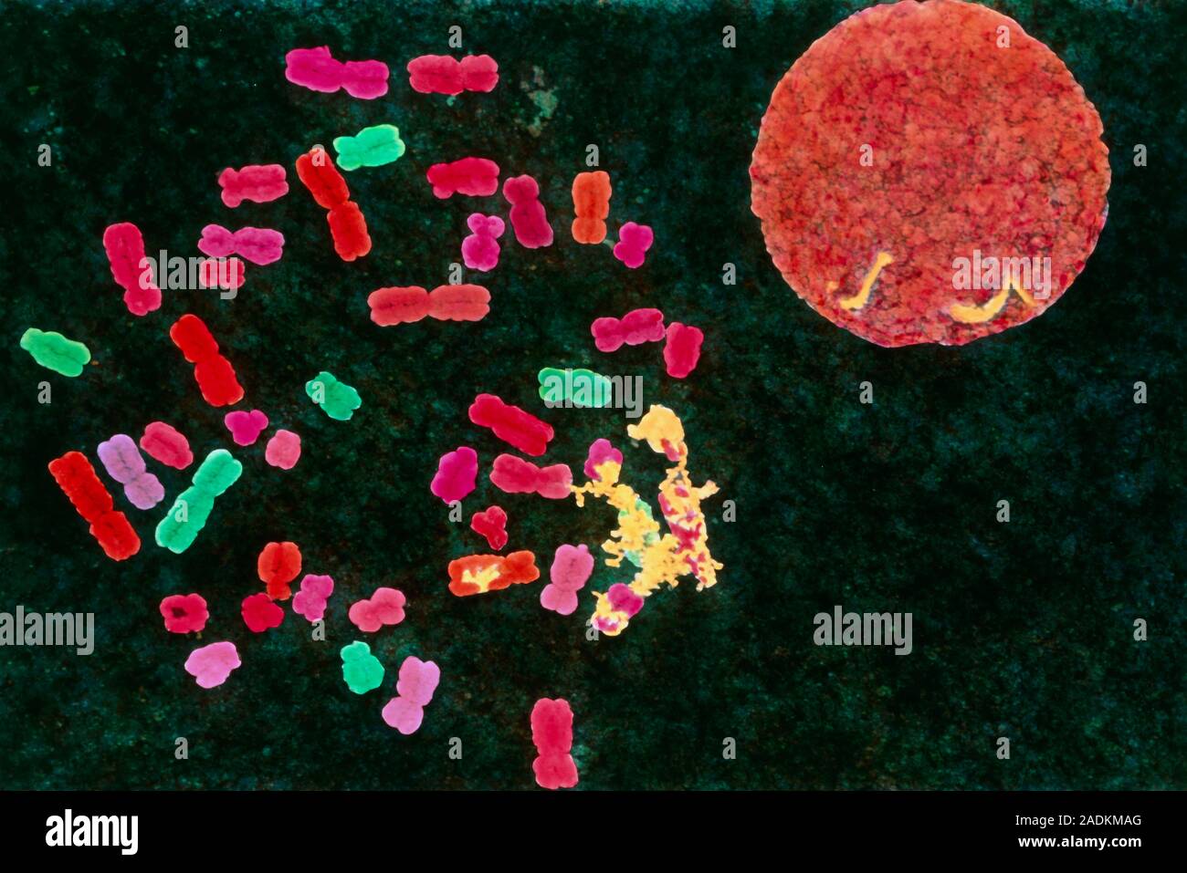 Human chromosomes. Coloured Scanning Electron Micrograph (SEM) of the ...