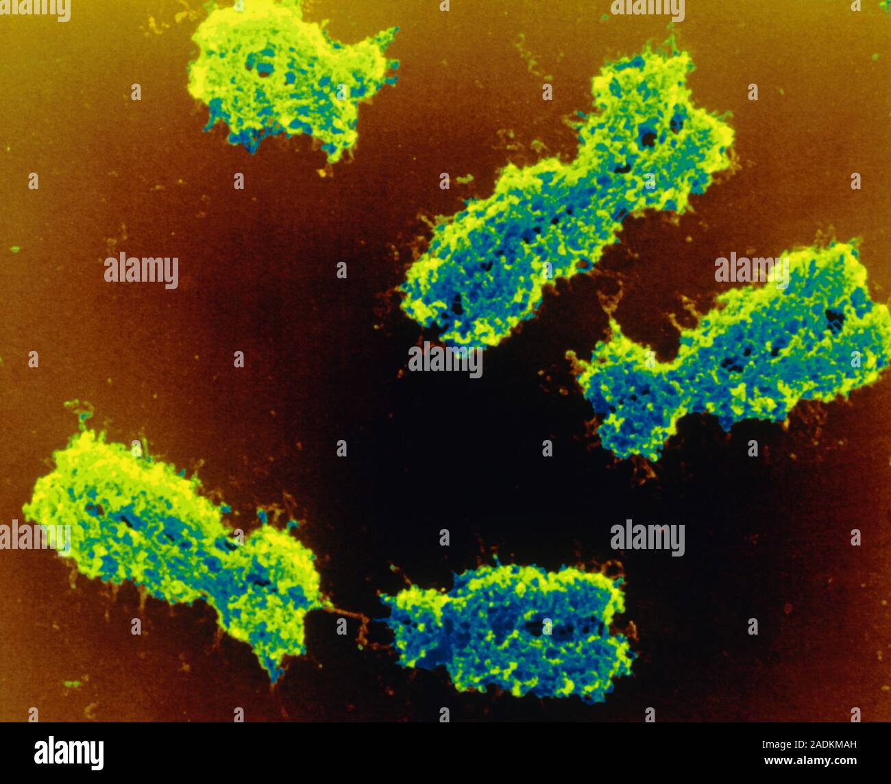 Human chromosomes. Coloured Scanning Electron Micrograph (SEM) of ...