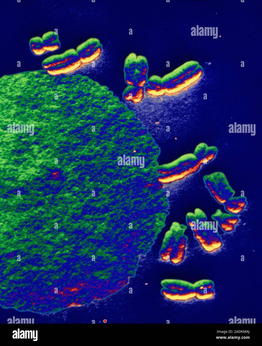 Human chromosomes. Coloured Scanning Electron Micrograph (SEM) of ...