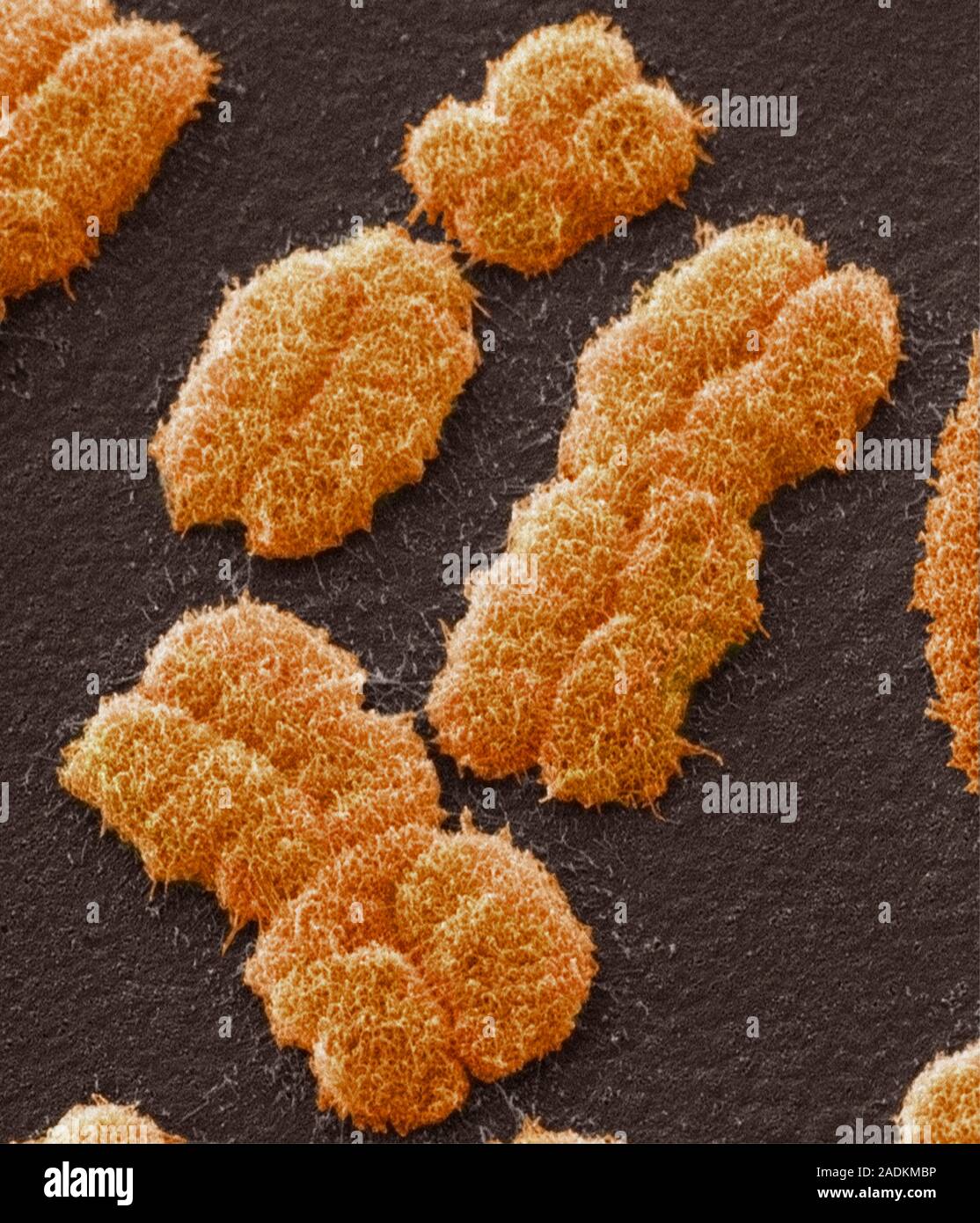 Human chromosomes. Coloured scanning electron micrograph (SEM) of a ...