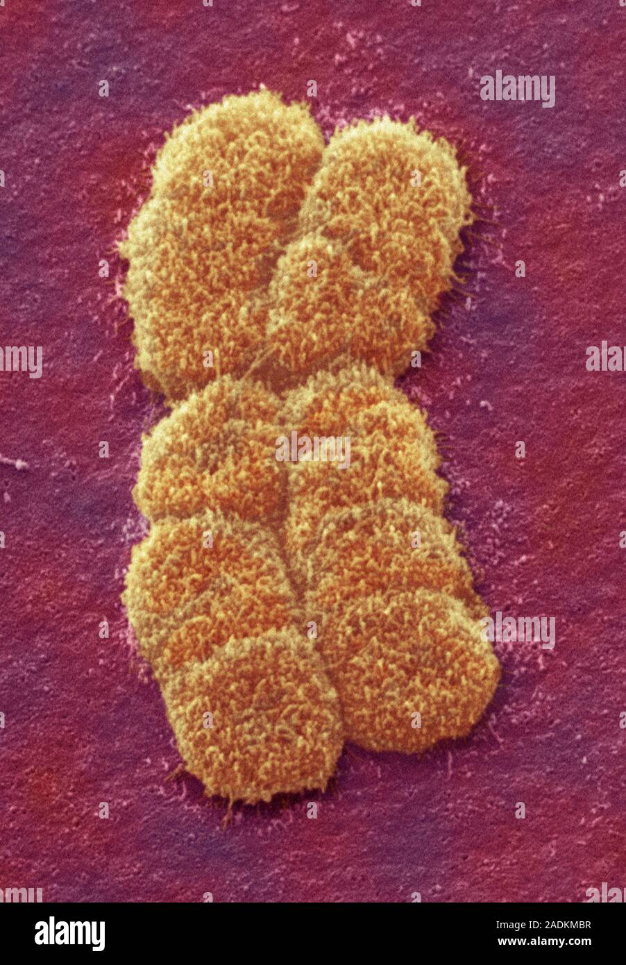 Human chromosome. Coloured scanning electron micrograph (SEM) of a ...