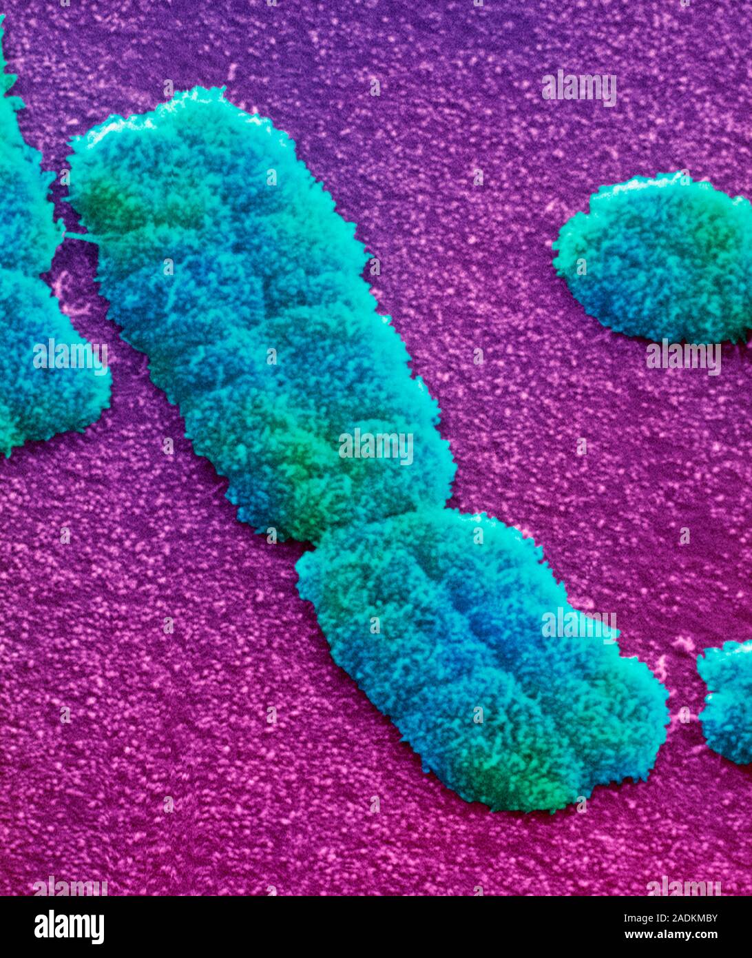 Human chromosome. Coloured scanning electron micrograph (SEM) of a ...