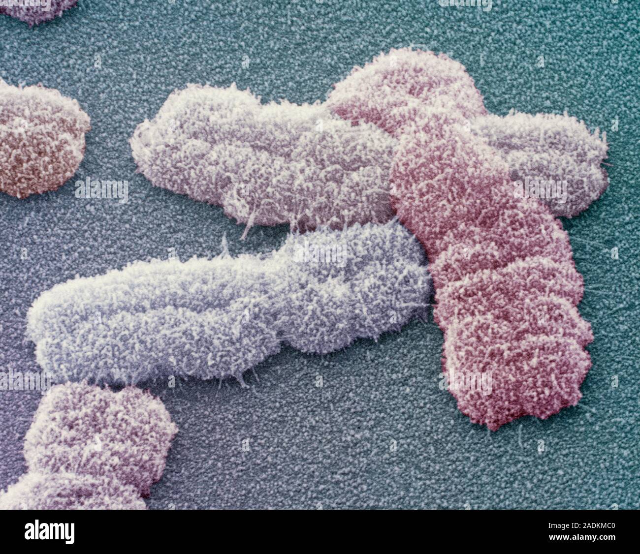 Human chromosomes. Coloured scanning electron micrograph (SEM) of a ...