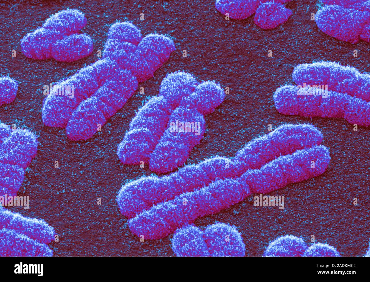 Human chromosomes. Coloured scanning electron micrograph (SEM) of a ...
