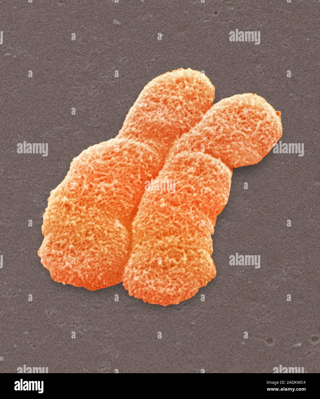 Human chromosomes. Coloured scanning electron micrograph (SEM) of a ...