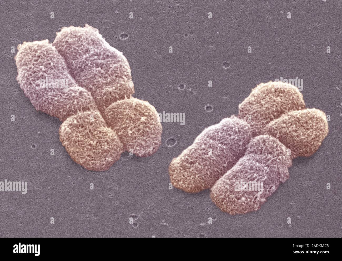 Human chromosomes. Coloured scanning electron micrograph (SEM) of pairs ...