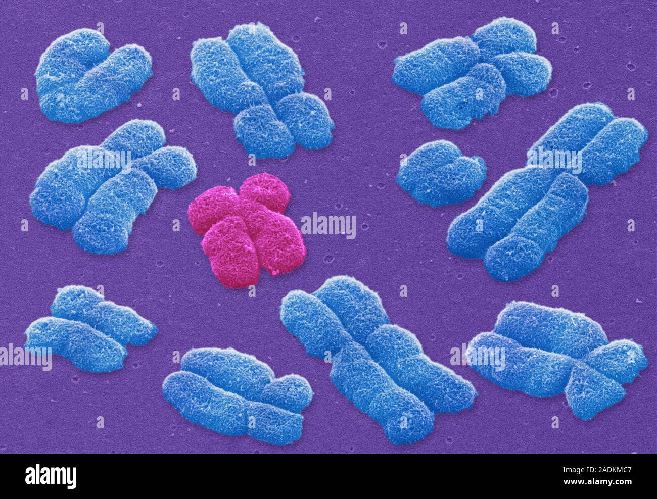 Human chromosomes. Coloured scanning electron micrograph (SEM) of pairs ...
