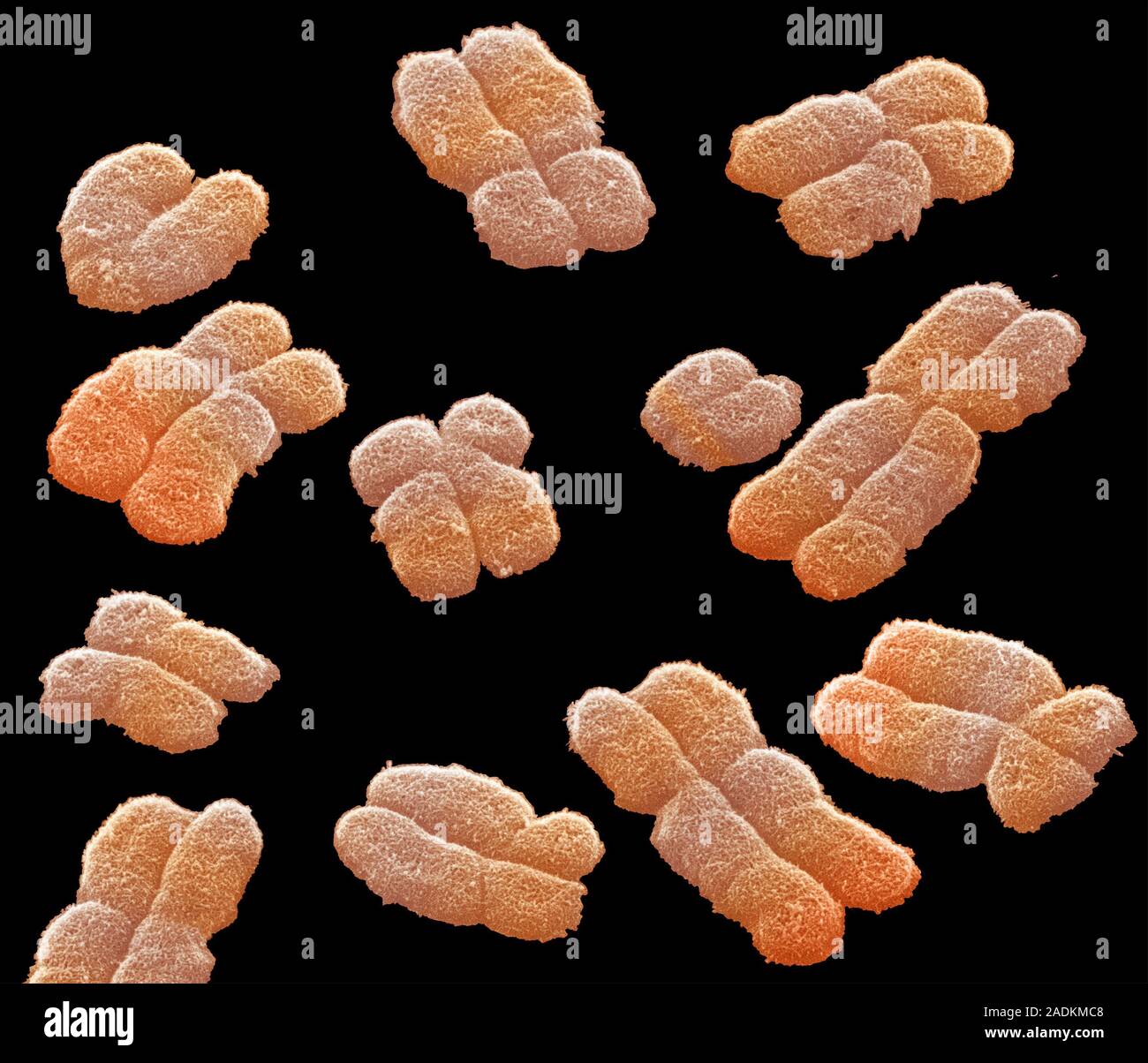 Human chromosomes. Coloured scanning electron micrograph (SEM) of pairs ...