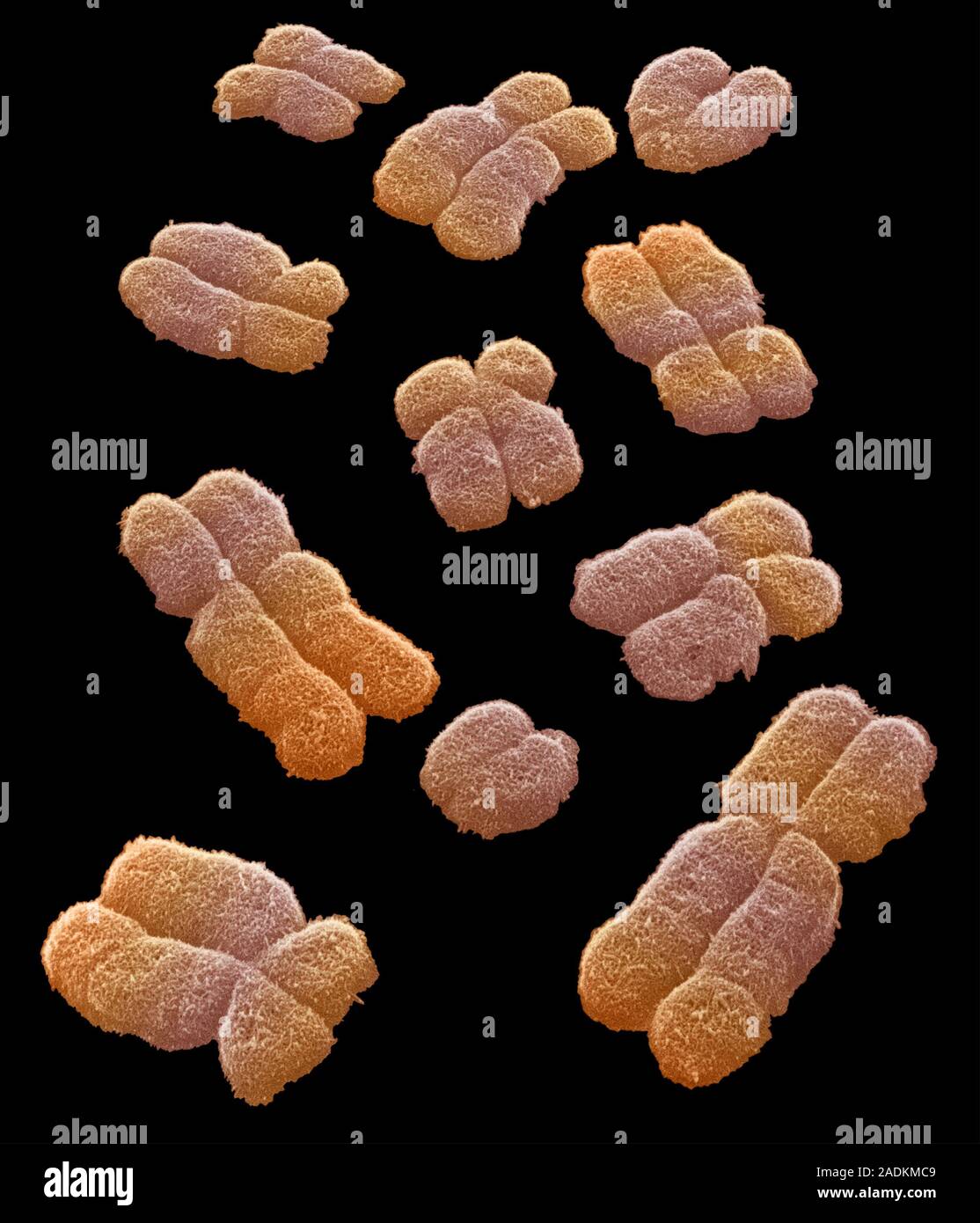 Human chromosomes. Coloured scanning electron micrograph (SEM) of pairs ...