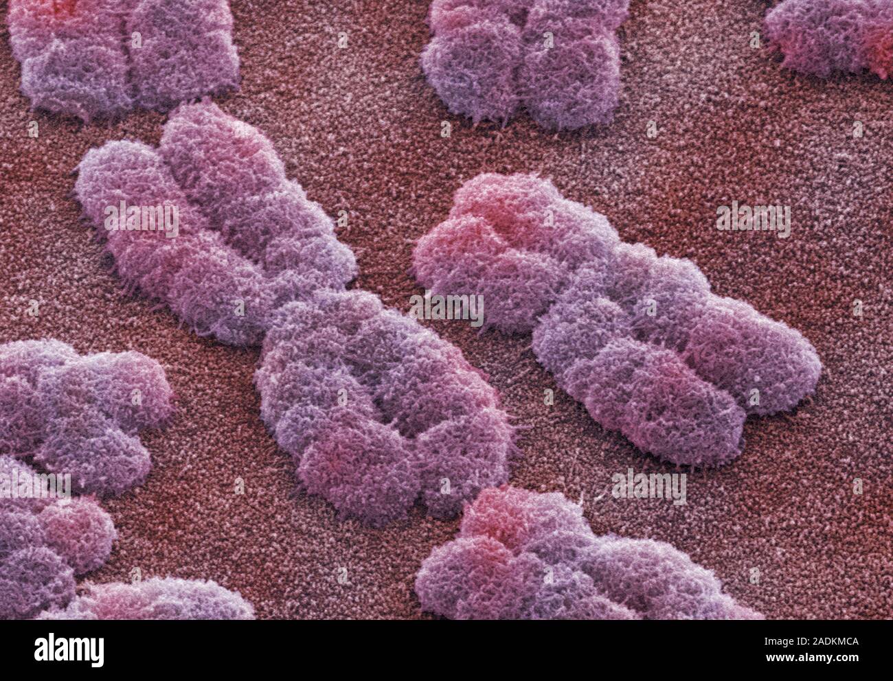 Human chromosomes. Coloured scanning electron micrograph (SEM) of human ...