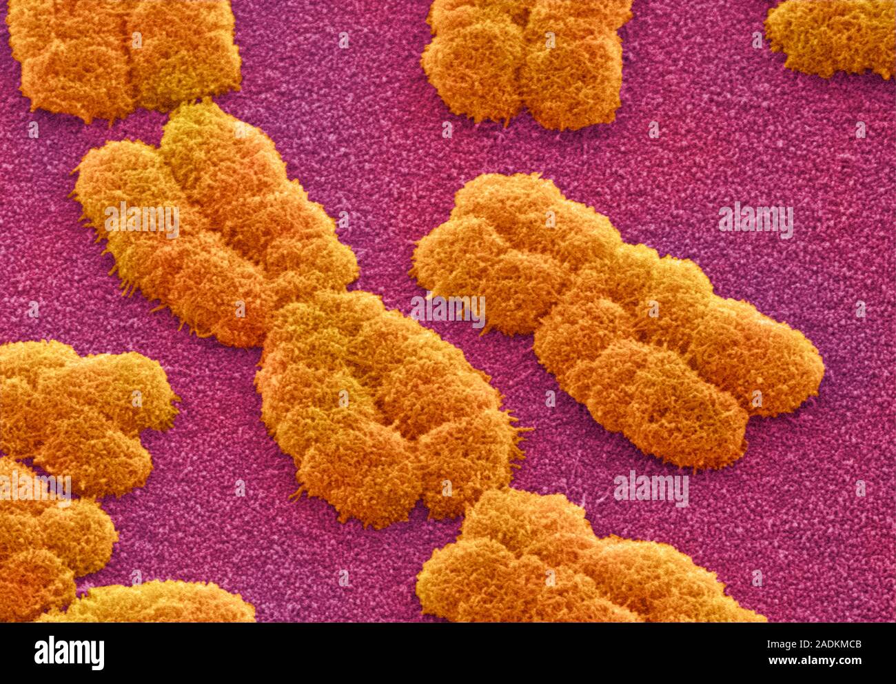 Human chromosomes. Coloured scanning electron micrograph (SEM) of human ...