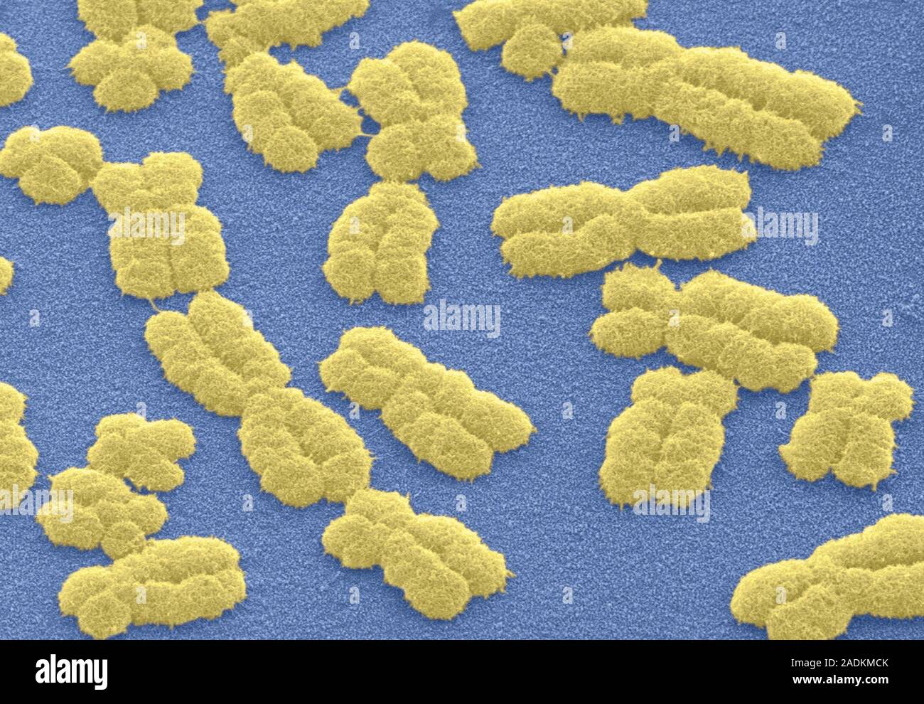Human chromosomes. Coloured scanning electron micrograph (SEM) of pairs ...