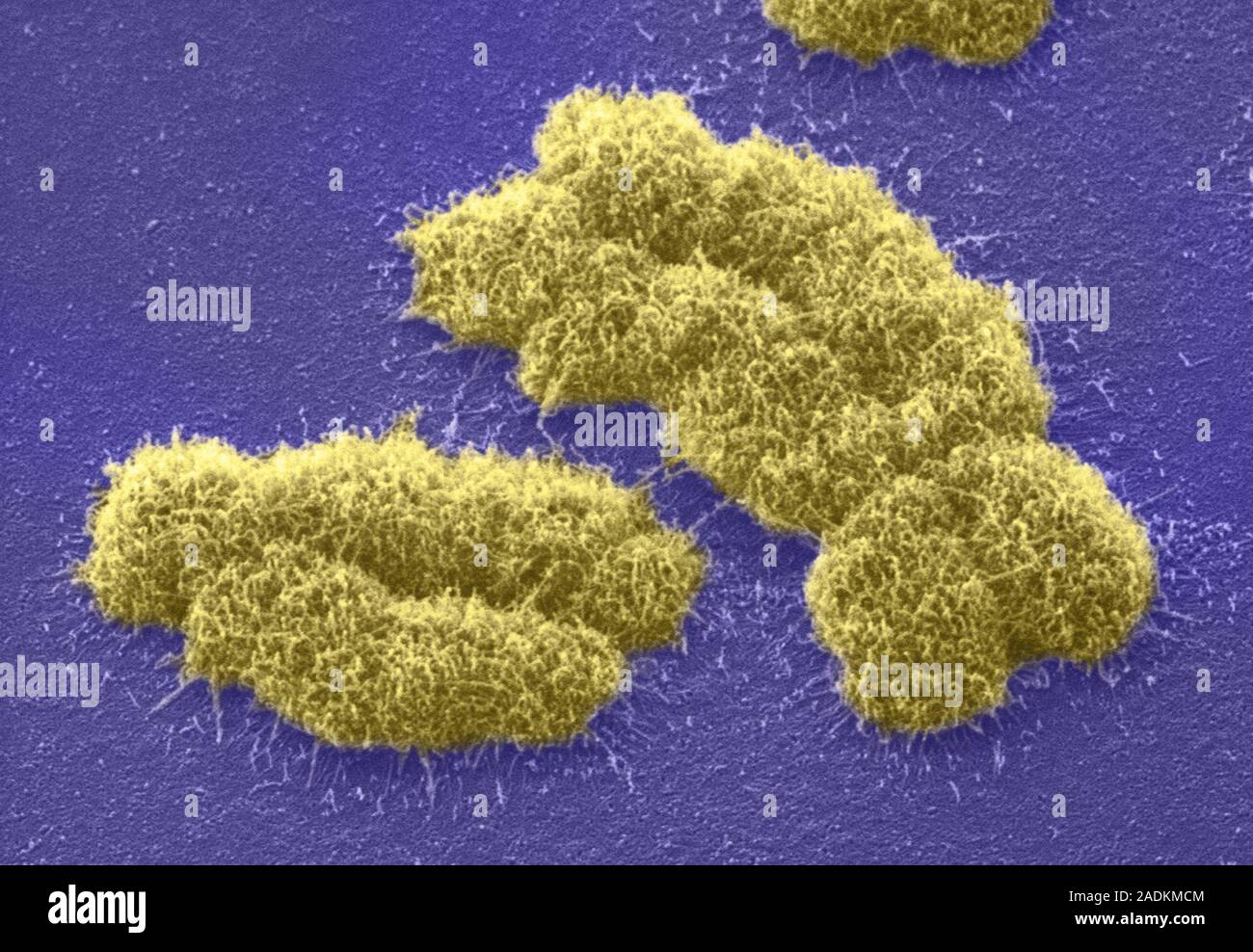 Human chromosomes. Coloured scanning electron micrograph (SEM) of two ...