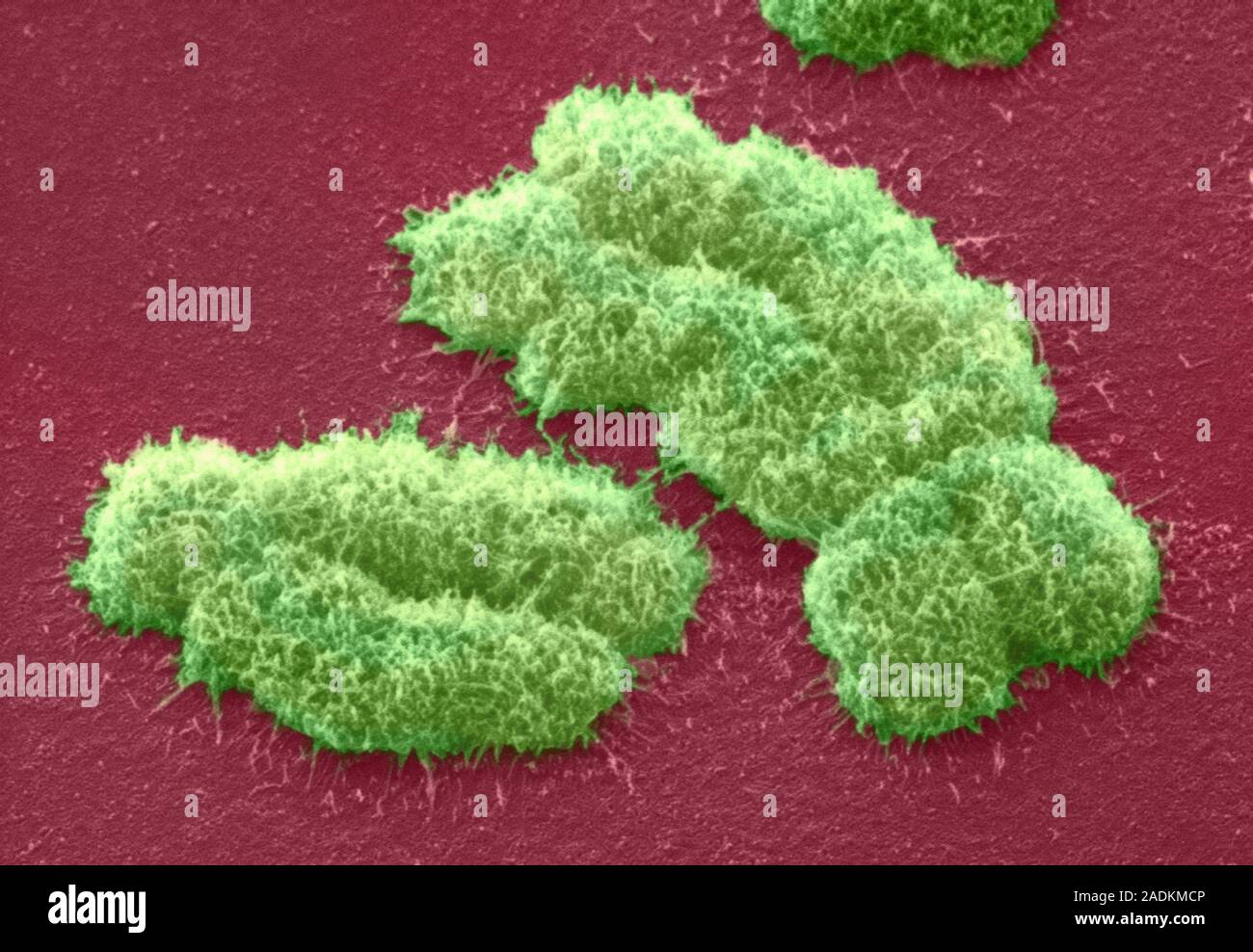 Human chromosomes. Coloured scanning electron micrograph (SEM) of two ...