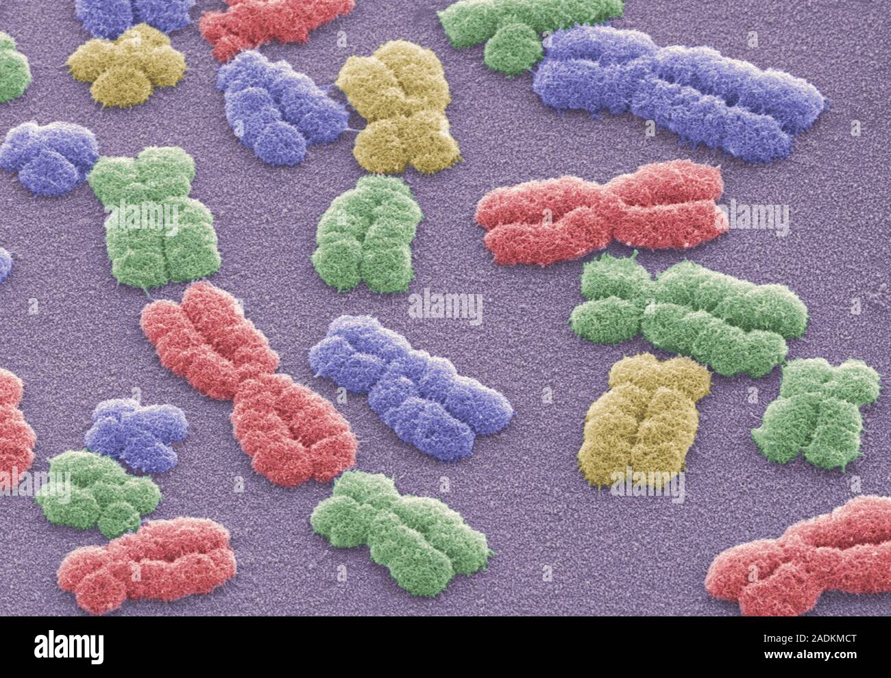 Human chromosomes. Coloured scanning electron micrograph (SEM) of human ...