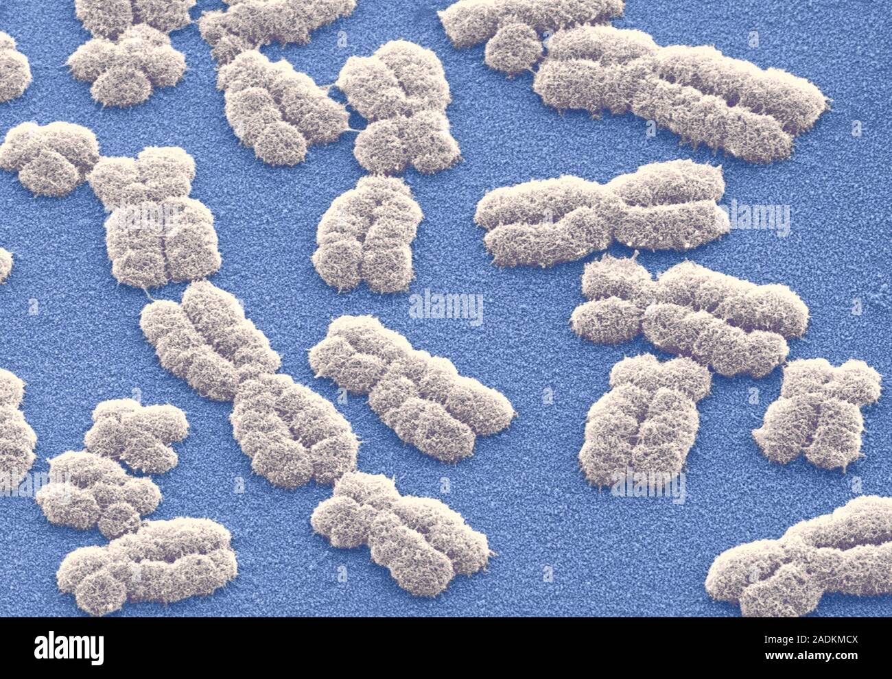 Human chromosomes. Coloured scanning electron micrograph (SEM) of human ...