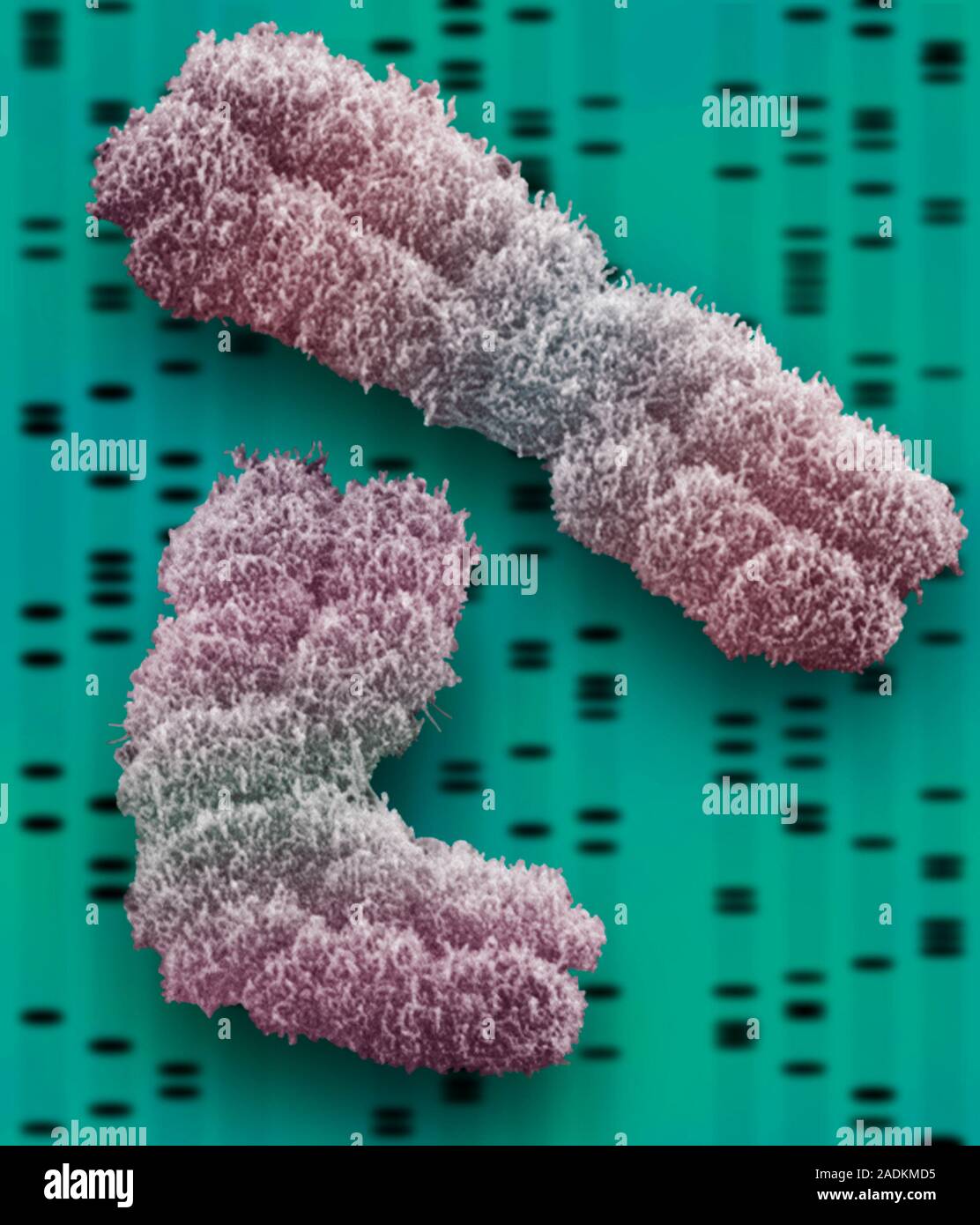 Chromosomes. Coloured scanning electron micrograph (SEM) of two ...