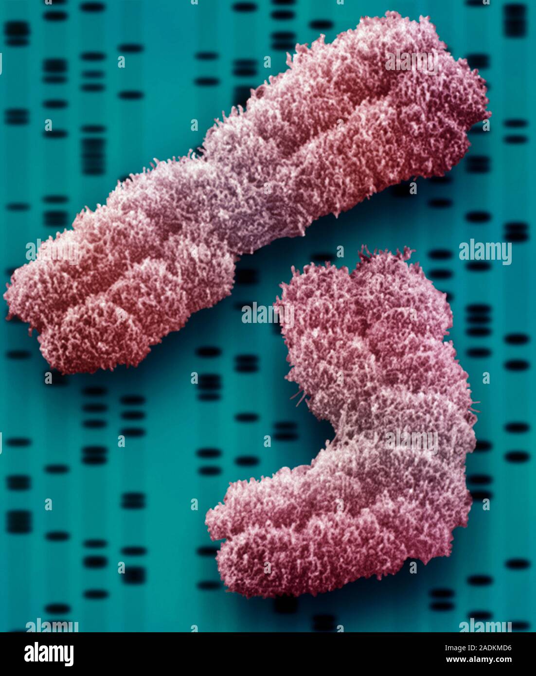 Chromosomes. Coloured scanning electron micrograph (SEM) of two ...